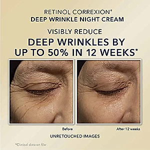 RoC Retinol Value Set Duo, Deep Wrinkle Anti-Aging Night Face Cream + Retinol Correxion Daily Eye Cream, Under Eye Cream for Dark Circles & Puffiness, Moisturizer for Deep Set Wrinkles