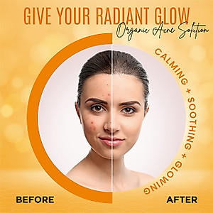 DERMAXGEN Organic Turmeric Soap Bar | Pure Natural Handcrafted Skincare, Face & Body Cleanser | Blemish Control, Reduce Acne, Evens Tone, Fades Scars, Sun Damage, Age Spots - 3.5 Oz