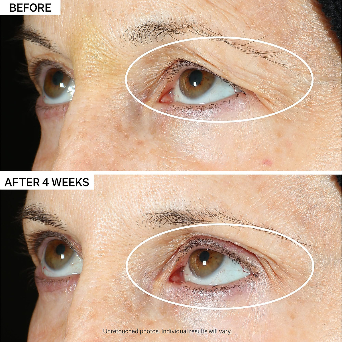 StriVectin Tighten and Lift Peptight 360 Degree Eye Serum with Tightening and Brightening Peptides for Wrinkles, Under Eye Bags and Puffiness, 1 fl. Oz