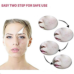 AGRCARE Hydrocolloid Acne Pimple Patch for Face, Zit Patch, Acne Dots, Clear Acne Stickers