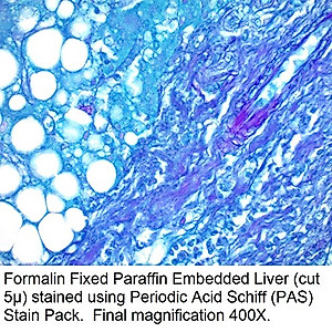 Periodic Acid Schiff (PAS) Stain Pack, 500ml