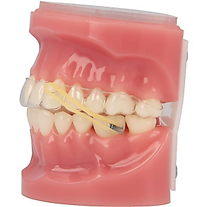 American Orthodontics Elastics Wildlife Gorilla | Medium, 4.5 Oz, 3/16" Size, 100 Packs Per Box, 10,000 Total | Made in The USA | Exacting Dimensions, Precision Cutting, Top Quality Latex Tubing