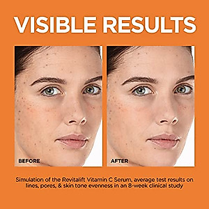 L'Oreal Paris Revitalift 12% Pure Vitamin C Serum, Vitamin E, Salicylic Acid, Moisturizing, Smoothing & Brightening, Non Greasy + Moisturizer Sample