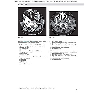 Head and Neck Imaging: Case Review Series