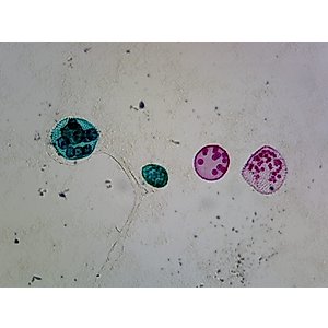 Volvox, Sexual Reproduction - Microscope Slide