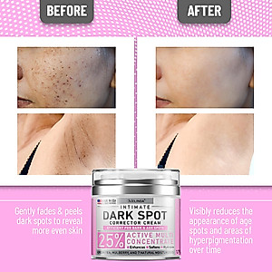 Dark Spot Corrector Cream for Face, Body & Sensitive Areas - Made in USA - Dark Spot Remover with Arbutin & Hyaluronic Acid - Even Skin Tone - 1.7 Oz