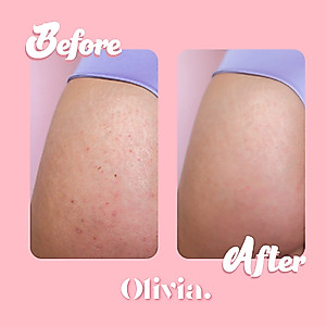 Olivia Beauty Butt Acne Cream | Body Butter Unicorn | Brightens Skin, Evens Tone | Natural Ingredients: Mango Butter, Cocoa, Coconut Oil | Hydrates & Smooths | Paraben-Free | 8 oz