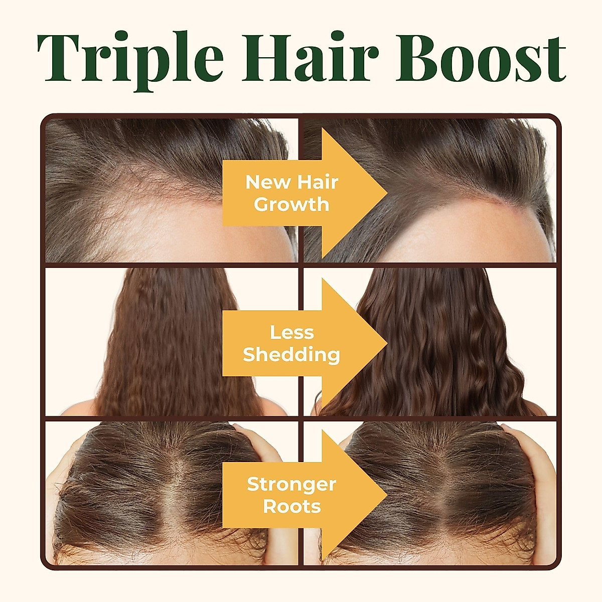 Heebin's Hair Growth Supplements with Biotin 4000 mcg, DHT Blocker and Collagen, for Hair Loss, Thinning and Regrowth, 60 Tablets, 2 Month Supply