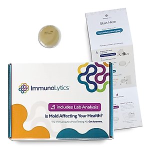 Premium Mold Test Kit (1 Room/Plate) Protect Your Home & Family with The Most Accurate DIY Mold Detection – Lab-Grade Plates, UV-Proof Storage, Expert Lab Analysis, and Satisfaction Guarantee