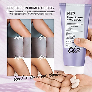 KP Bump Eraser Body Scrub, Exfoliating Body Scrub, Body Exfoliator Scrub, KP Body Scrub for Women Strawberry Legs, Effective Body Scrubs for Women Exfoliation Bump Eraser