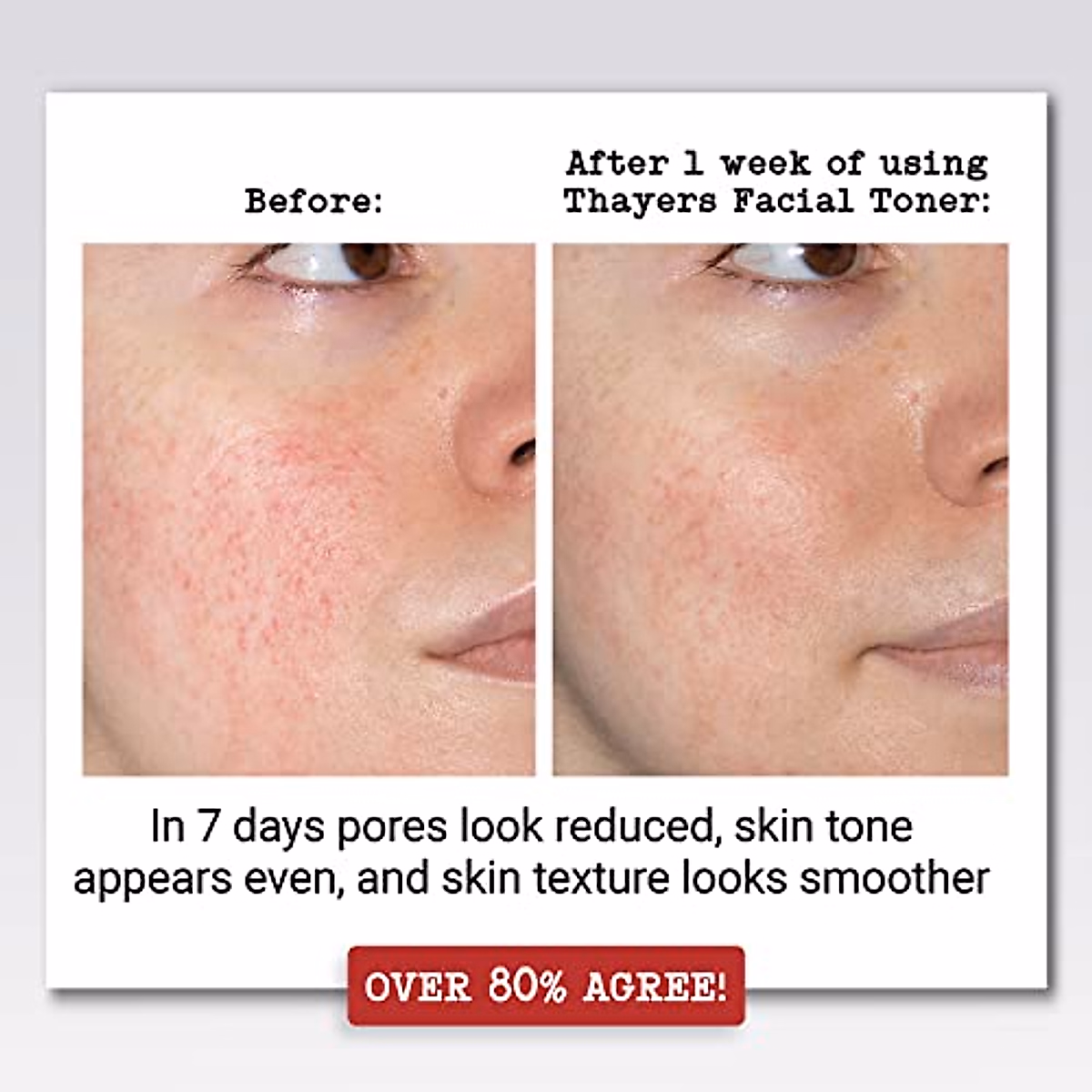 THAYERS Alcohol-Free Rose Petal Witch Hazel Facial Toner with Aloe Vera Formula, 12 Ounce