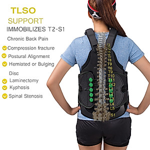 TODDOBRA TLSO Thoracic Full Back Brace for Men and Women - Universal Treat Kyphosis, Compression Fractures, Osteoporosis, Upper Spine Injuries, and Pre or Post Surgery with Hard Lumbar Support ( Size XXL)