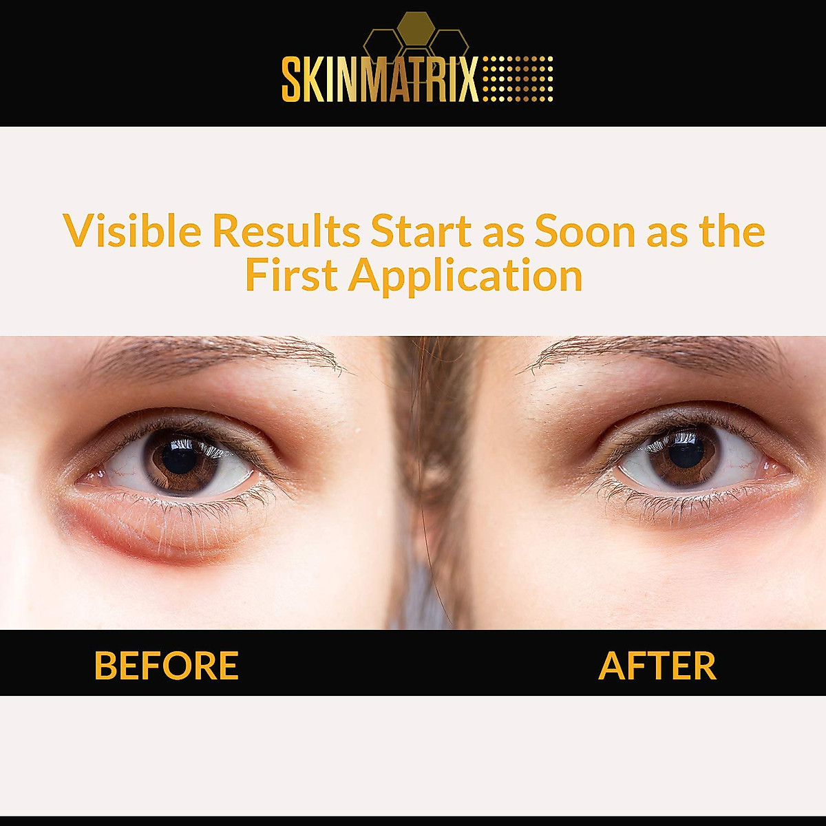 Puffy Eyes Treatment Serum- Anti Aging Under Eye Cream Formula for Puffiness, Dark Circles, Fine Lines, Wrinkles & Under Eye Bags with Hyaluronic Acid & Vitamin C. Instant Results within Minutes.