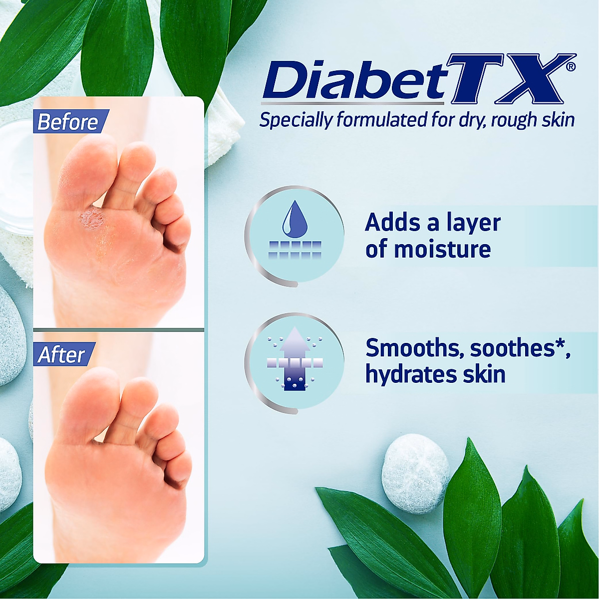 Goicoechea Diabet TX Body Lotion for Diabetic Dry Skin, Hydrating Diabetic Skin Cream for Women and Men, Diabetic Moisturizer for Hands, Legs, and Body, Extra Dry Skin Relief, 13.5 Oz