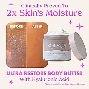 Kopari Ultra Restore Body Butter with Hyaluronic Acid and Vitamin B5 - Vegan Moisturizing Lotion for Dry Skin, 7.7 oz