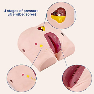 Human Wound Care Model Bedsore Nursing Human Model Pressure Ulcers Manikin Teaching Human Simulator for Nursing Teaching