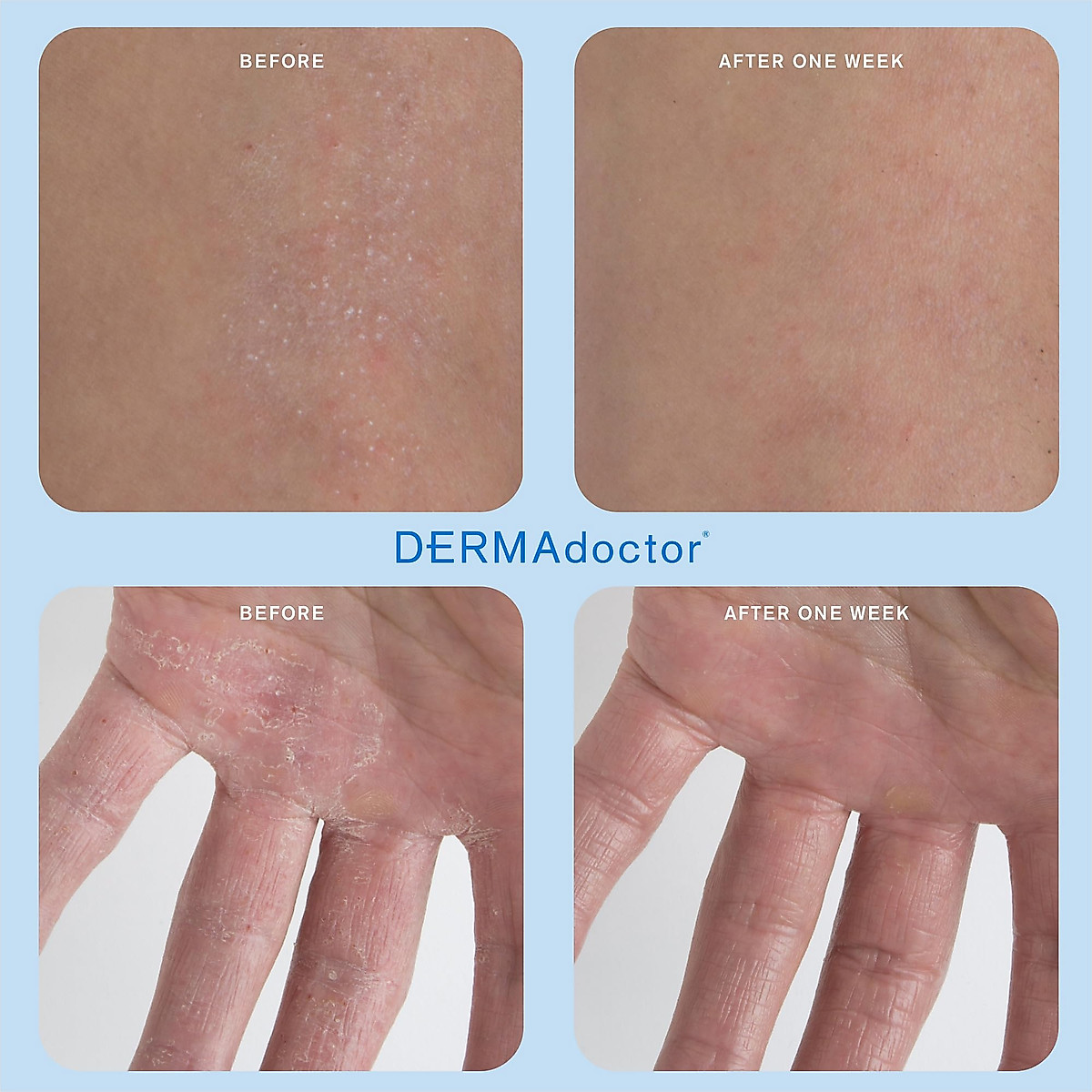 DERMAdoctor Calm Cool + Corrected Clinical Hydra Repair Cream for Face and Body with 1% Colloidal Oatmeal, Moisturizing Skin Repair for Dry, Eczema & Dermatitis Relief + Anti Itch - 6 oz