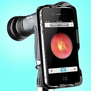 GSS Welch Allyn Iexaminer Adopter For Panoptic Ophthalmoscope #11840