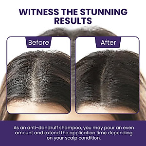 AtOne with Nature Dandruff Control Shampoo - 16 oz Liquid Shampoo for Dry Hair - Fresh Scent, Dandruff Control Solution