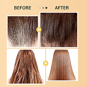 Scalp Scrub with Sea Salt and Ginger, Gentle Scalp Exfoliating, Removes Buildup, Dandruff Dry Scalp Treatment and Nourishing Hair, Parabens-free (10.6 oz / 300 g)