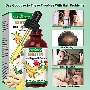 5 PACK Ginger Oil for Hair Growth,Hair Growth Serum,Biotin Hair Growth Oil,Hair Growth Ginger Serum for Men and Women,Hair Growth Treatment,Hair Loss Treatment,Promotes Thicker,Growth Hair