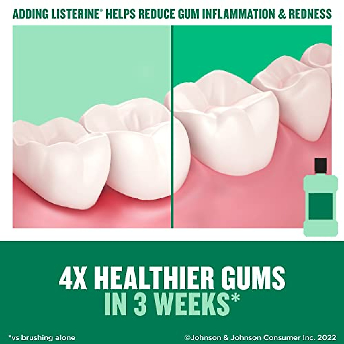 Listerine Freshburst Antiseptic Mouthwash for Bad Breath, Kills 99% of Germs That Cause Bad Breath & Fight Plaque & Gingivitis, ADA Accepted Mouthwash, Spearmint, 500 mL (Pack of 2)