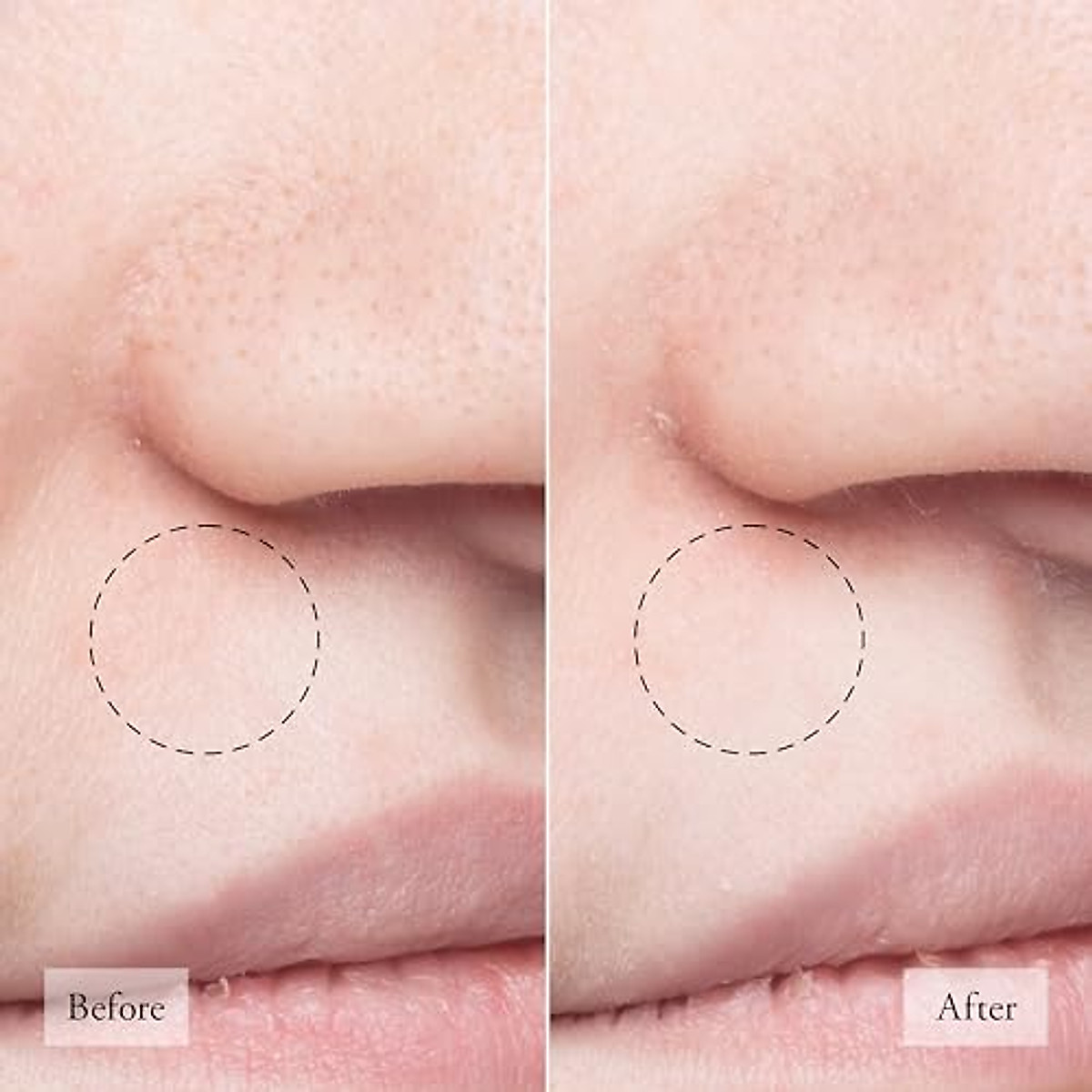 philosophy purity made simple pore extractor mask