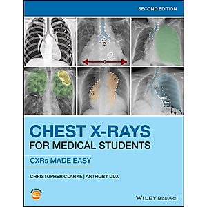 Chest X-Rays for Medical Students: CXRs Made Easy