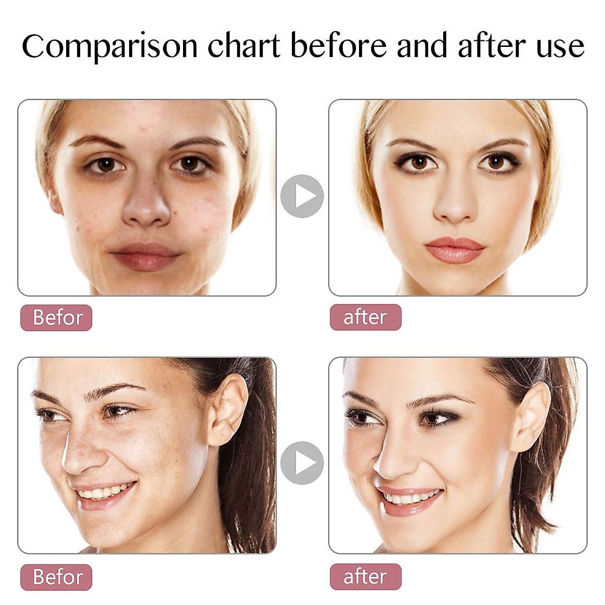 Meifuly Light Therapy Face Mask, 7 Colors L E D Facial Face Mâsk