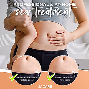 JJ CARE Soft Silicone Tape, 1.6” x 120” Flexible Silicone Scar Tape, Medical Grade Silicone Strips for Scars, Washable & Reusable Scar Tape for Surgical Scars, Latex-Free Scar Tape