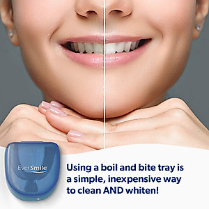 EverSmile Custom Foam Trays - Use With AlignerFresh Original Clean & OrthoFoam for an All-Around Deep Clean of Orthodontic Appliances and Teeth Whitener. Case included. (1pk)