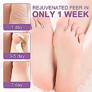 WEIDA SIGN Foot Peel Mask 3 Pack,For Cracked Heels, Dead Skin & Calluses - Exfoliator Remove Repair Rough Heels,Make Your Feet Baby Soft & Get a Smooth Skin (Lavender)