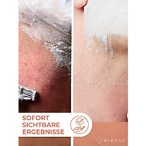 WLDOHO Double Edge Safety Razor - Natural Wooden Handle, Zero Waste and Plastic Free - Reusable Safety Razor for Men and Women - Traditional Shaver with 5 Blade