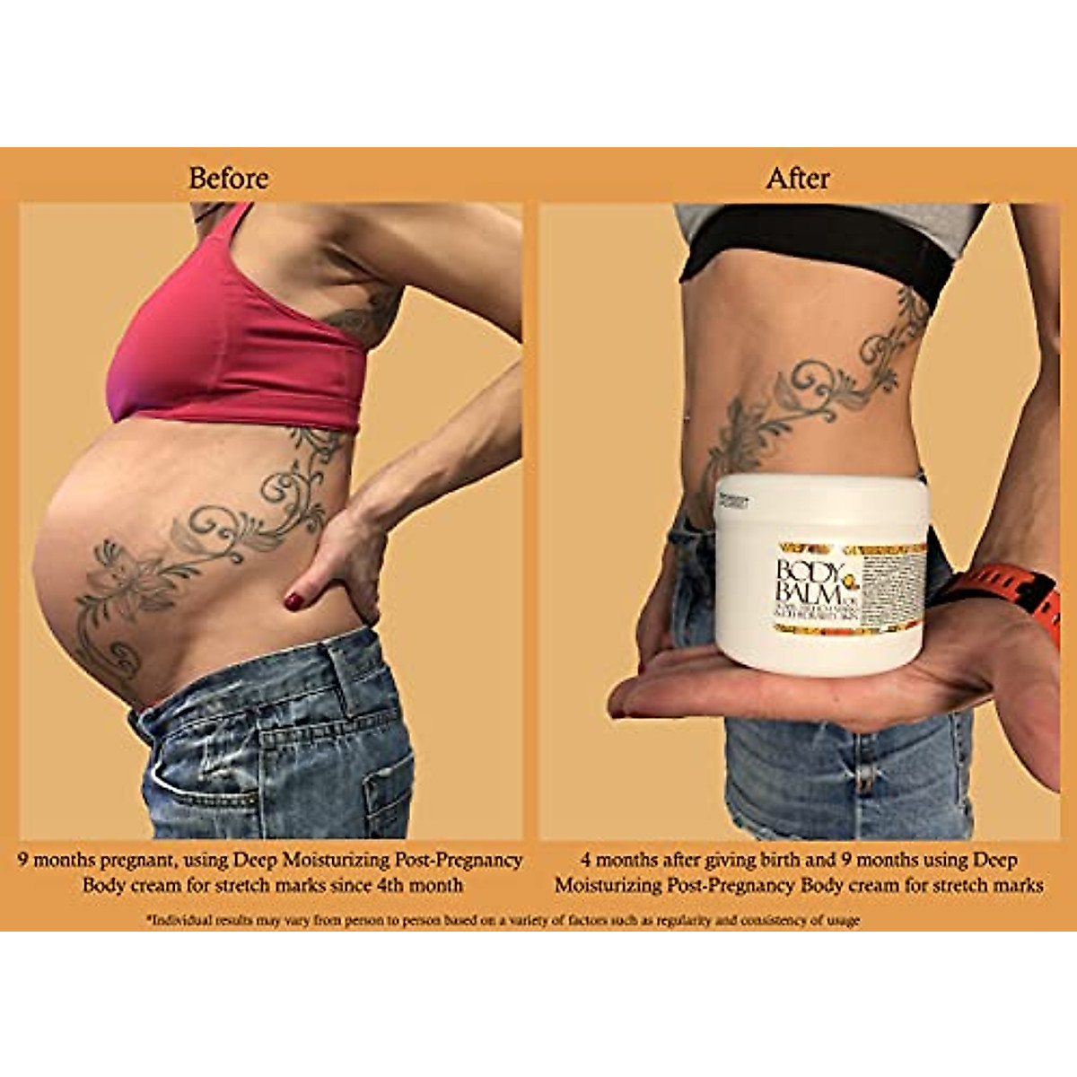 Stretch Mark Remover Cream | Firming, Hydrating, Tightening, Improves Skin Elasticity | Deep Moisturizing Post-Pregnancy Body cream for stretch marks | Naturally-Sourced Extracts and Oils Formula