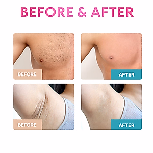 THBRO Hair Removal Cream-Painless Flawless Depilatory Cream, Skin Friendly Hair Remover Cream For Women and Men for Bikini Arm Leg Armpit