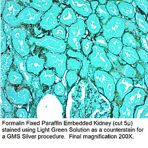 Light Green Solution, 1 Gallon