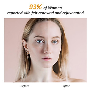 WarmDerm Skin Firming Facial Device, Professional Home Beauty Device for Face and Body, 3 Energy Levels - Salon Results