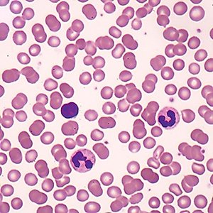 Human Blood Film Slide, Smear, Wright's Stain