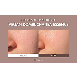 Dr.Ceuracle by leegeehaam Vegan Kombucha Cream Essence (150 ml / 5.07 fl. oz.) - All-in-One Hydrating Serum formulated Kombucha Tea Extract, Paraben Free, Cruelty-Free Korean Skincare