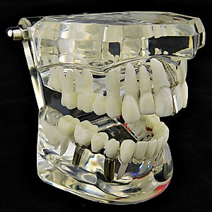 Gap Grillz Silver Tone Single Plain Tooth Top or Bottom Teeth Single Hip Hop Grills