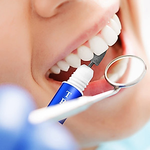 Healvian 2pcs Portable Dental Picks Teeth Stain Remover Mini Travel Plaque and Tartar Remover with Chain Mini Stain Eraser Oral Cleaning Tools for Travel Home