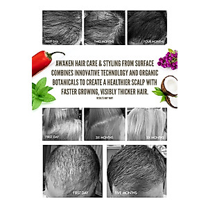 Surface Hair Awaken Kit: Shampoo, Conditioner, Scalp Elixir and Therapeutic Treatment - for Thinning Hair, Hair Loss and Thickening