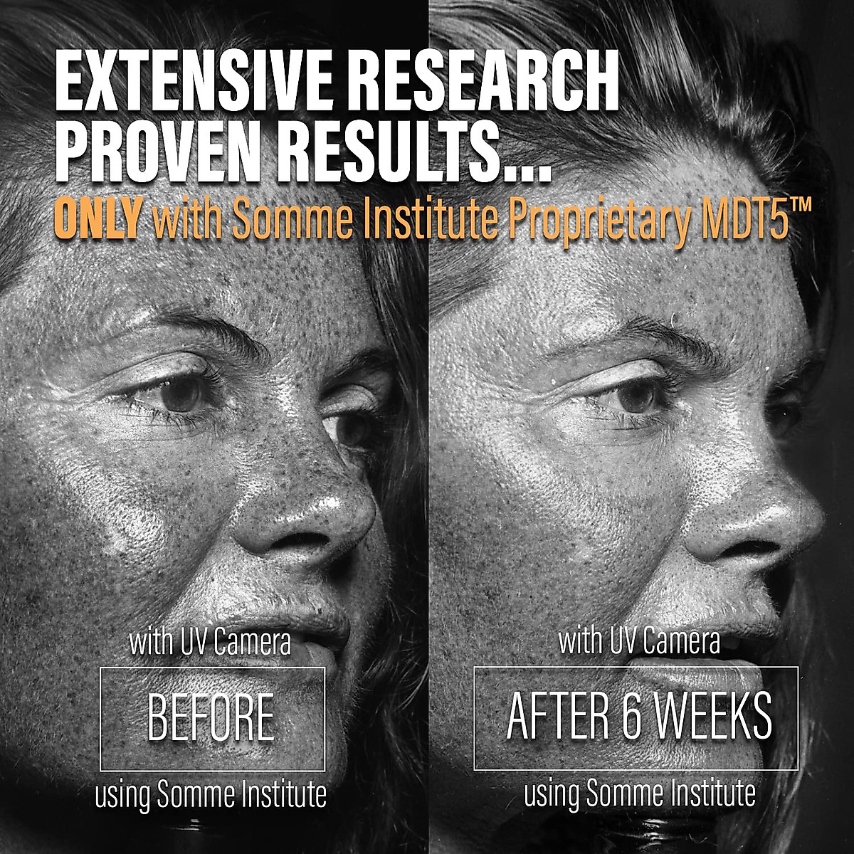 Exfoliating Glycolic Acid Pads | Anti-Aging, Smoothing, Resurfacing Pads | Somme Institute Transport Alcohol-Free Brightening Pads for Gentle Dirt Removal and Pore Cleansing | 50 Ct.