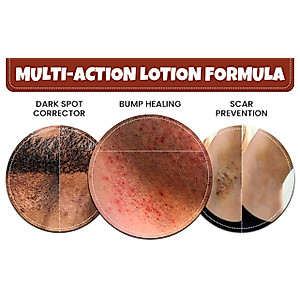 Bump Zapper Anti Bump Soothing Lotion