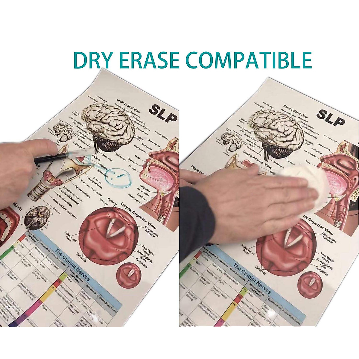 Larynx, Sound Production, Speech Articulation, Articulation LP 24x36 inch, 4 Poster Set