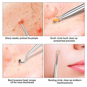 Blackhead Remover Tools, 7Pcs Pimple Acne Blemish Removal Tools Set Zit Extractor with Tin Case by JAZZZNAP, Silver
