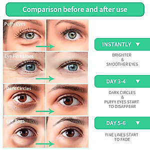 BREYLEE Aloe Vera Eye Mask– 60 Pcs - Eye Treatment Mask, Under Eye Bags Treatment, Under Eye Masks for Puffy Eyes, Anti-Aging,Anti-Wrinkle and Fine Lines, Under eye Dark Circles