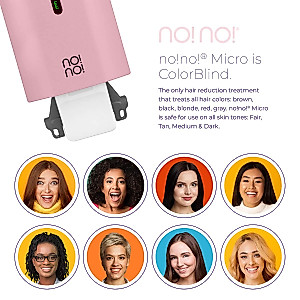 no!no! Micro Hair Removal Device for All Skin Tones, Body & Facial Hair Removal for Women & Men, Rechargeable, Wireless & Portable Hair Removal Device, Flawless Hair Remover for Face & Body - Lilac