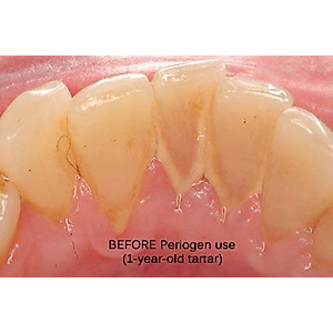 Periogen Complete Oral Health Rinse (3-PK)