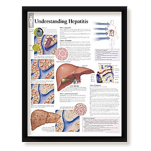 Set of 4 Framed Medical Posters Understanding Diabetes Understanding Cholesterol Understanding Metabolic Syndrome and Understanding Hepatitis 22"x28" Wall Diagrams